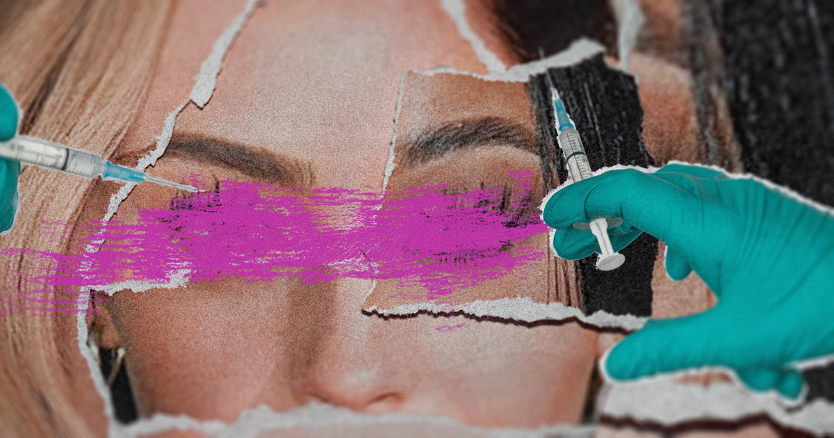 Så gör du botox och fillers – utan att det blir fult och farligt